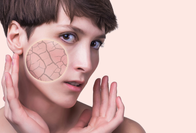 Dry vs Dehydrated Skin | Beauty & Cutie